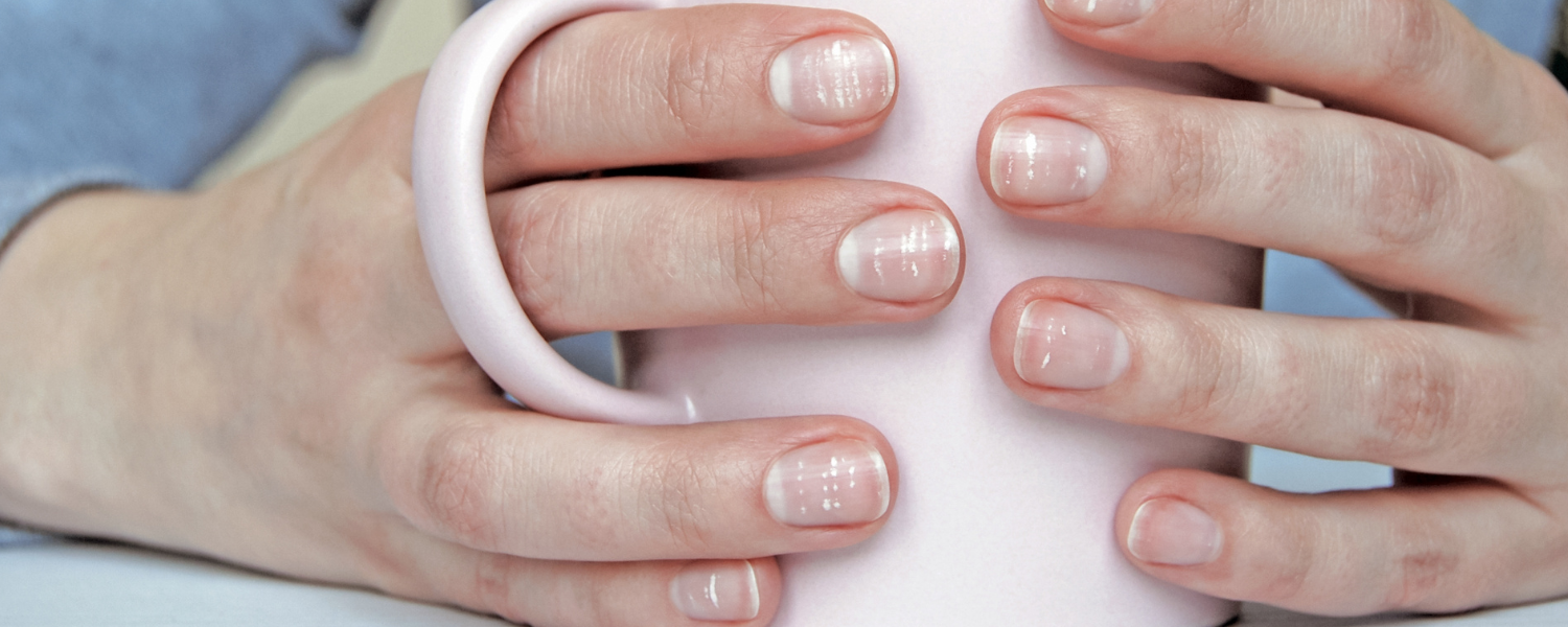 Nageldystrophie - Symptome, Ursachen und Behandlung
